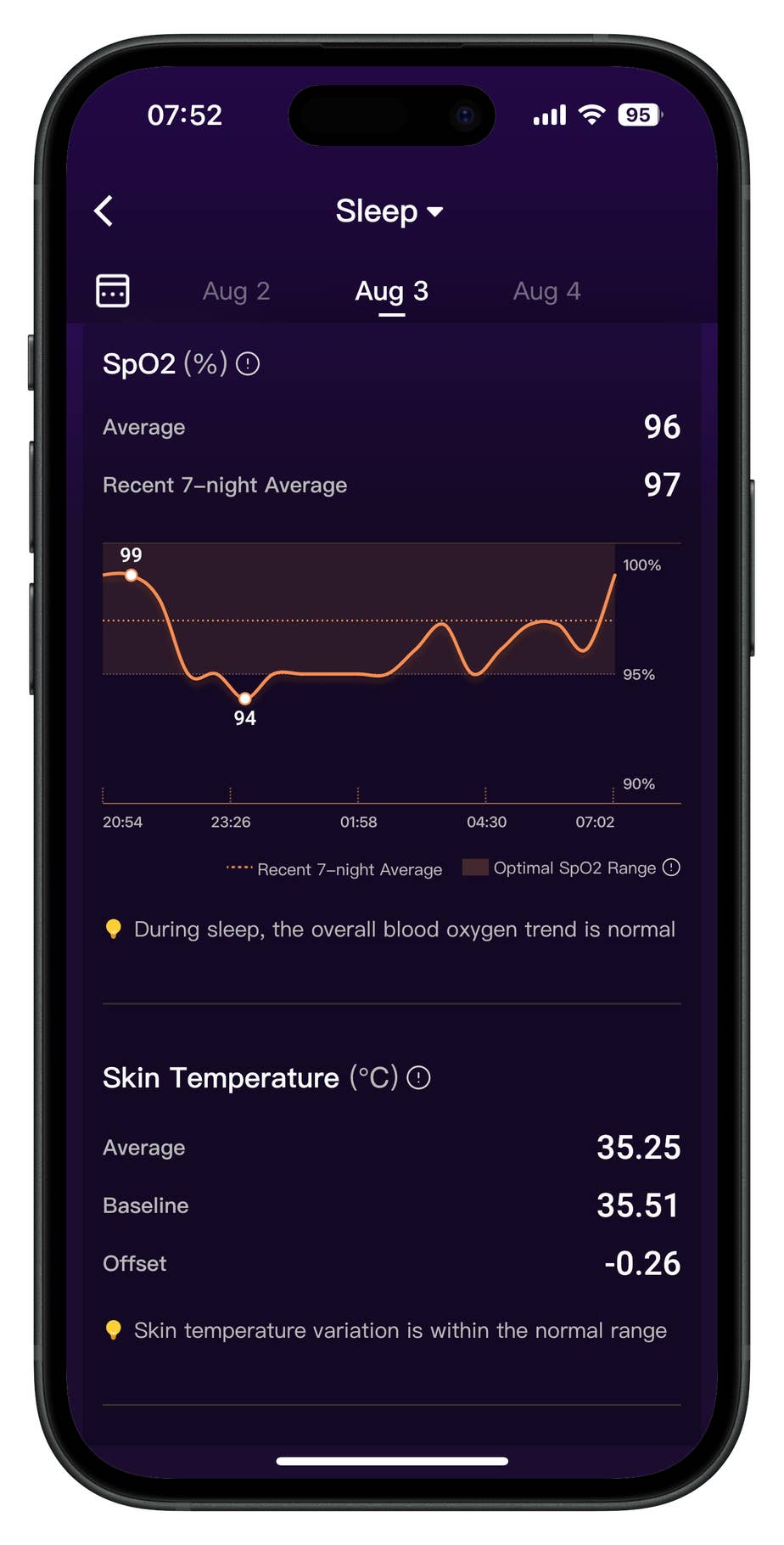 RingConn Gen 2 Smart Ring: Lighter, Thinner, and More Powerful